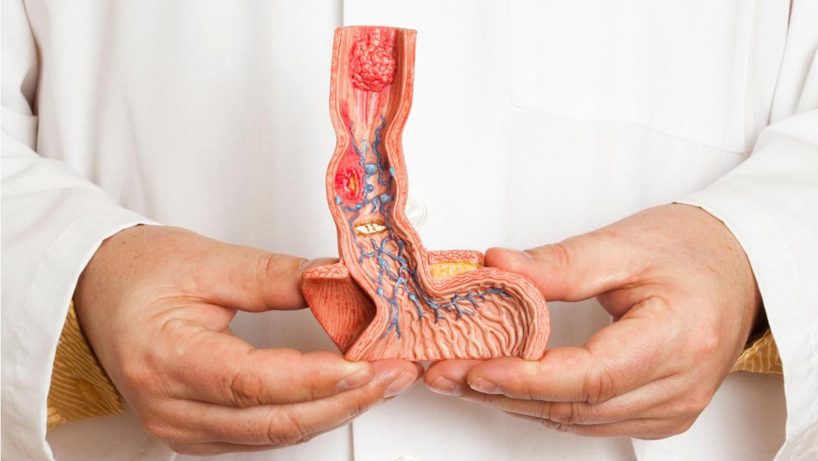 Tiroidectomía: principales detalles | Hospital de Bellvitge